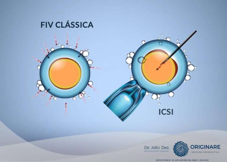 » FIV clássica x FIV com ICSI?